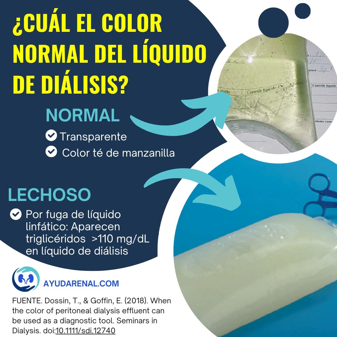 Líquido de diálisis lechoso